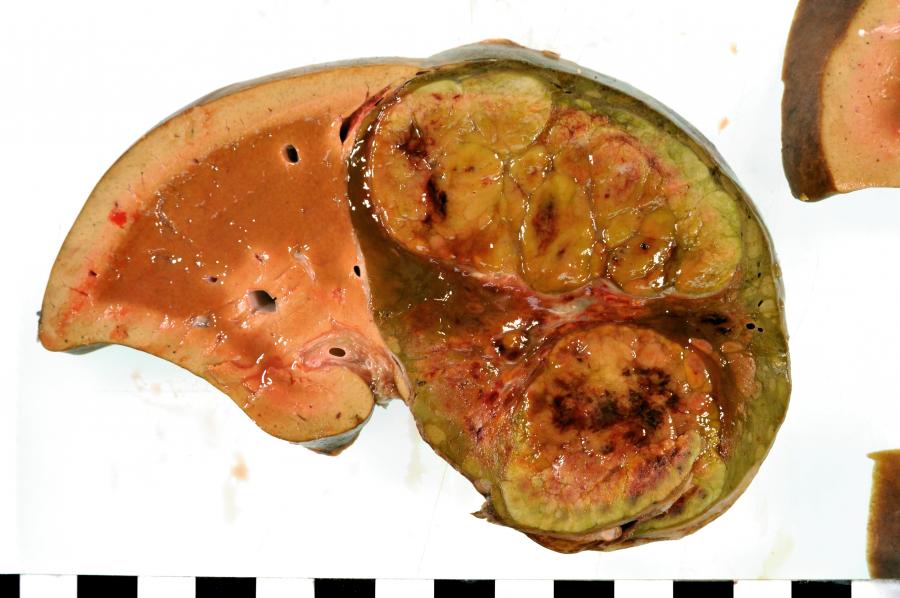 Virtual Pathology eLearning